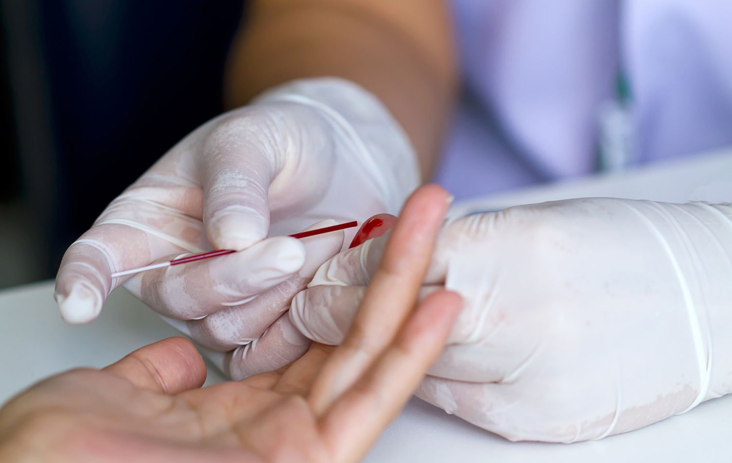 60SEC040 Capillary Blood Gas: Key Facts - EMS Education & Training