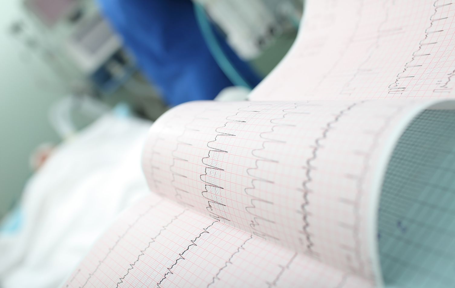60SEC057 ECG Lead II Interpretation: 8 Steps - EMS Education & Training
