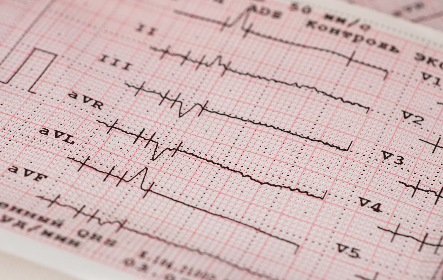 60SEC083 A Guide to ECGs - EMS Education & Training