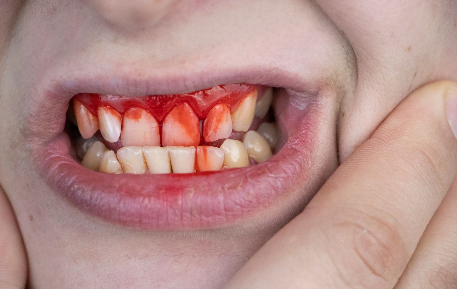 FACPD023 First Aid for Dental Emergencies - EMS Education & Training