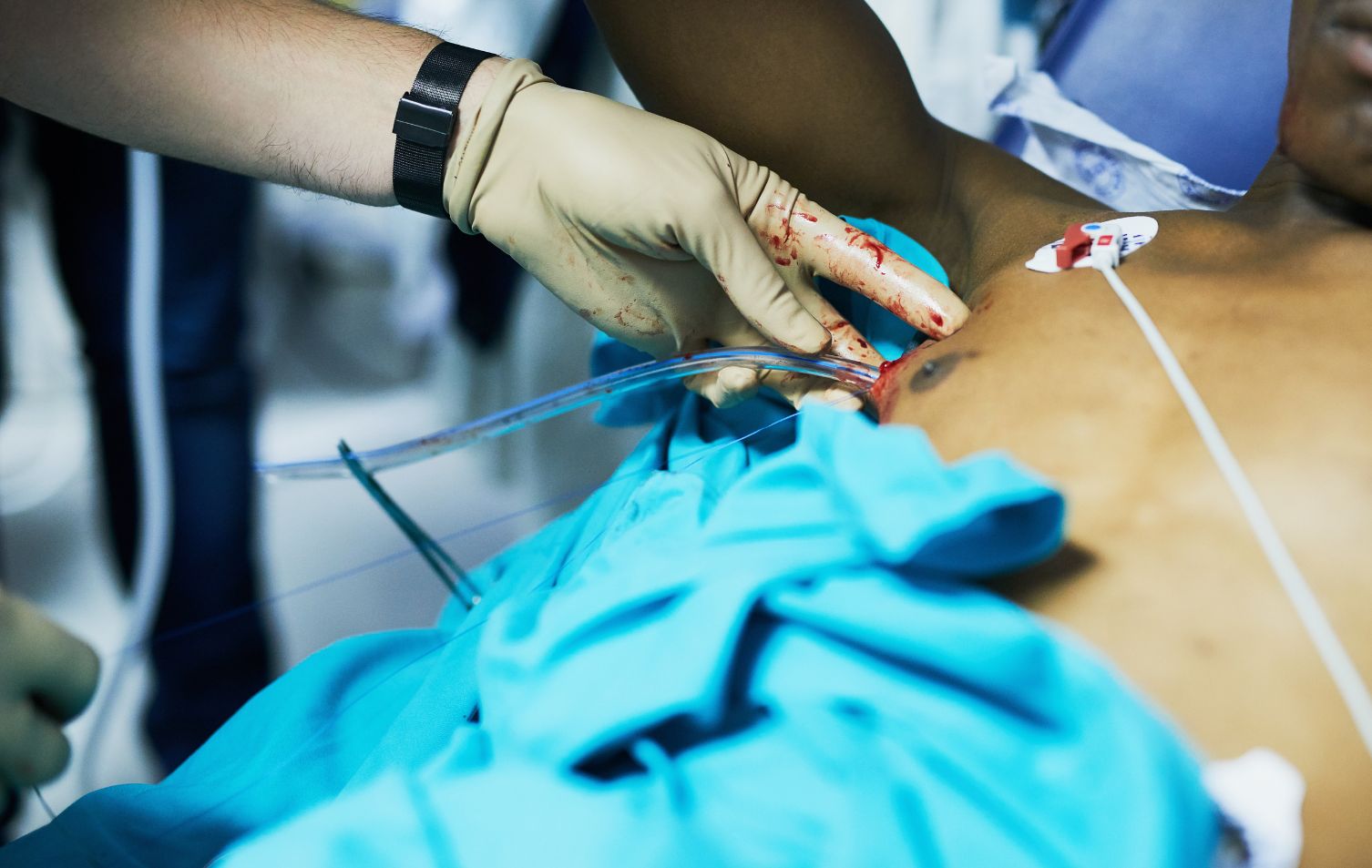 HCCPD113 Chest Trauma - EMS Education & Training